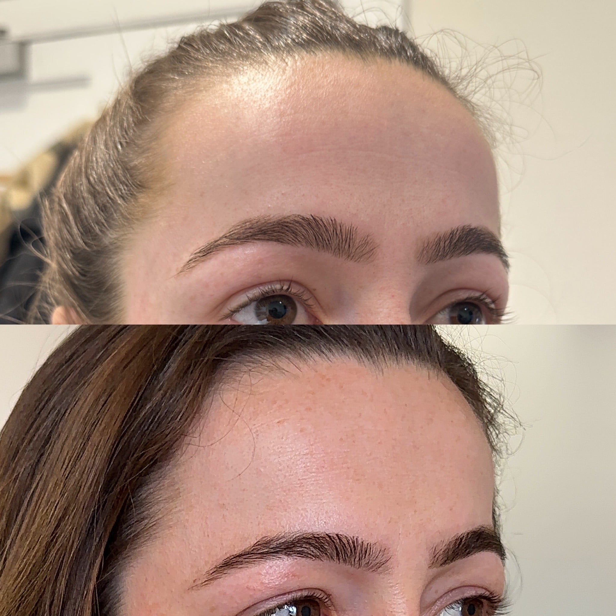 Poor Skin Barrier & Systemic Disease? – Harmony Skin